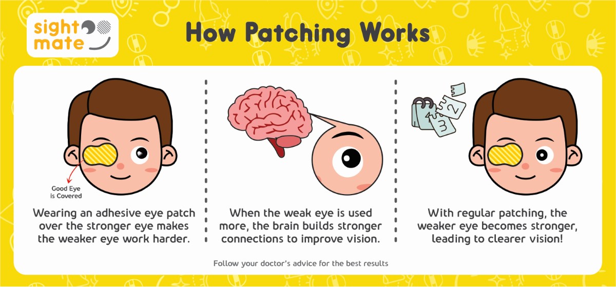 Amblyopia Eye Patch for Kids - SightMate Pakistan